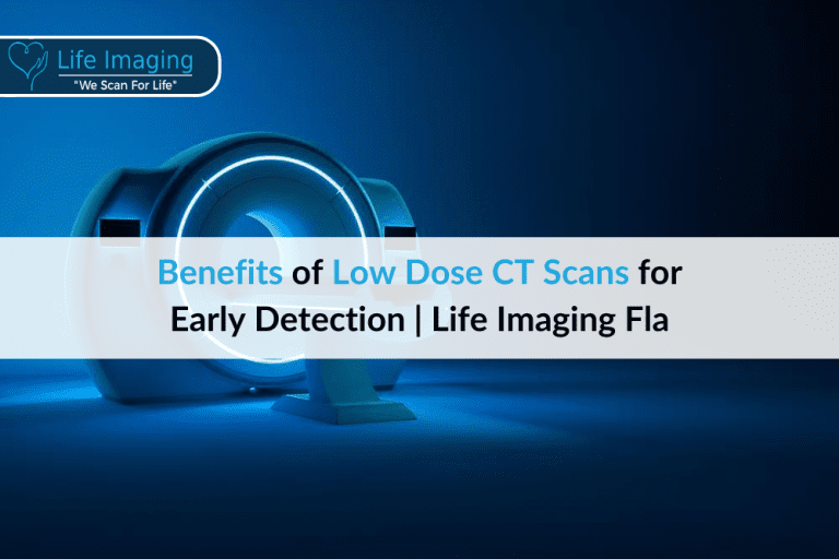 Benefits of Low Dose CT Scans for Early Detection - Life Imaging FLA