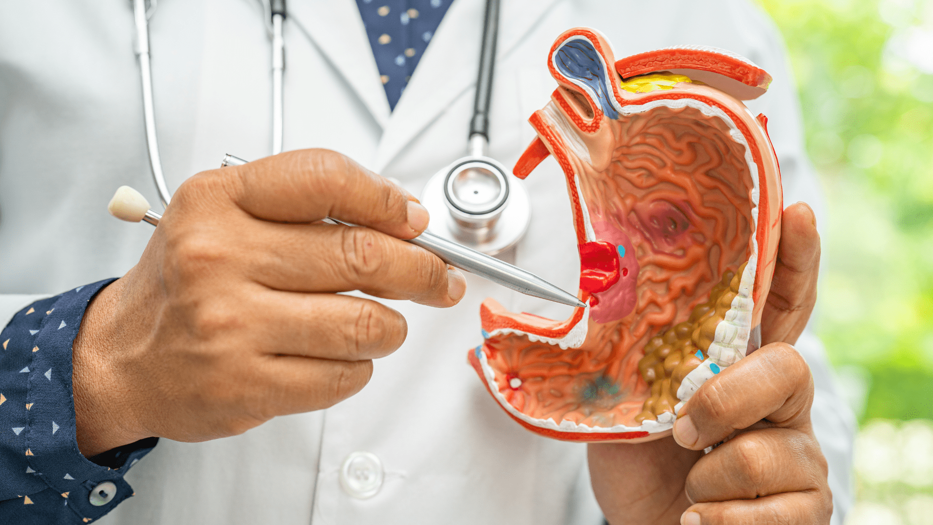 Stomach Cancer: Effective Early Detection Methods - Life Imaging FLA
