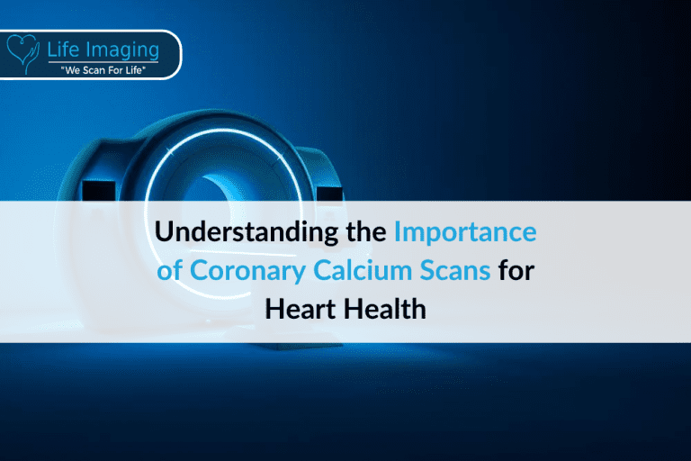Coronary Calcium Scans For Heart Health | Life Imaging FLA