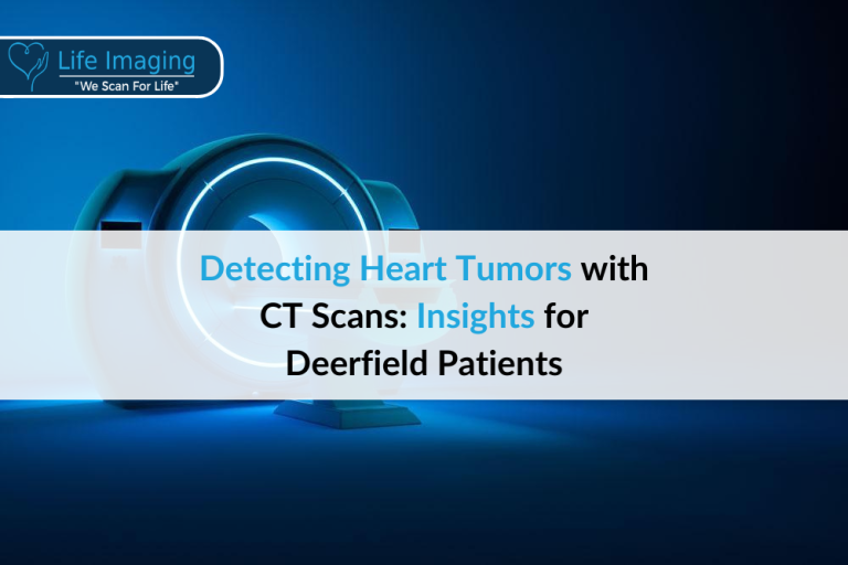 Detecting Heart Tumors with CT Scans in Deerfield - Life Imaging FLA