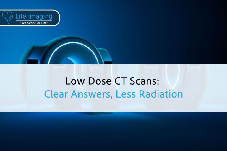 Low Dose CT Scan | Clear Imaging with Less Radiation – - Life Imaging FLA